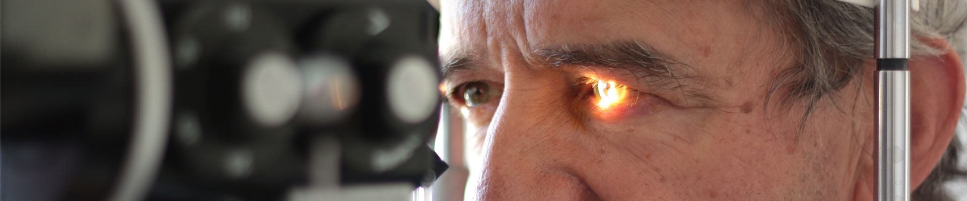 Le glaucome - symptômes et traitements